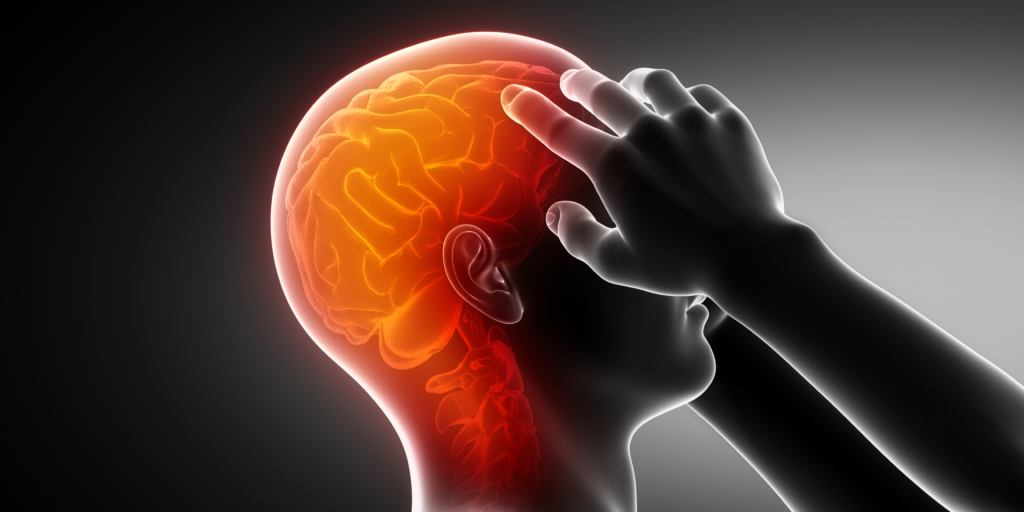 Understanding Migraine And The Different Types Of Migraines